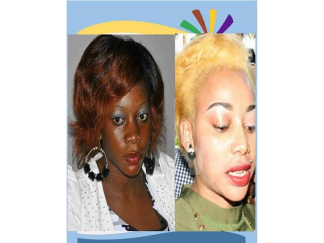 The unique skin care product from Rollyhampy +27760829927 | Health and ...